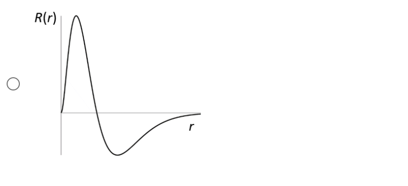 Solved Which of the following best represents the radial | Chegg.com