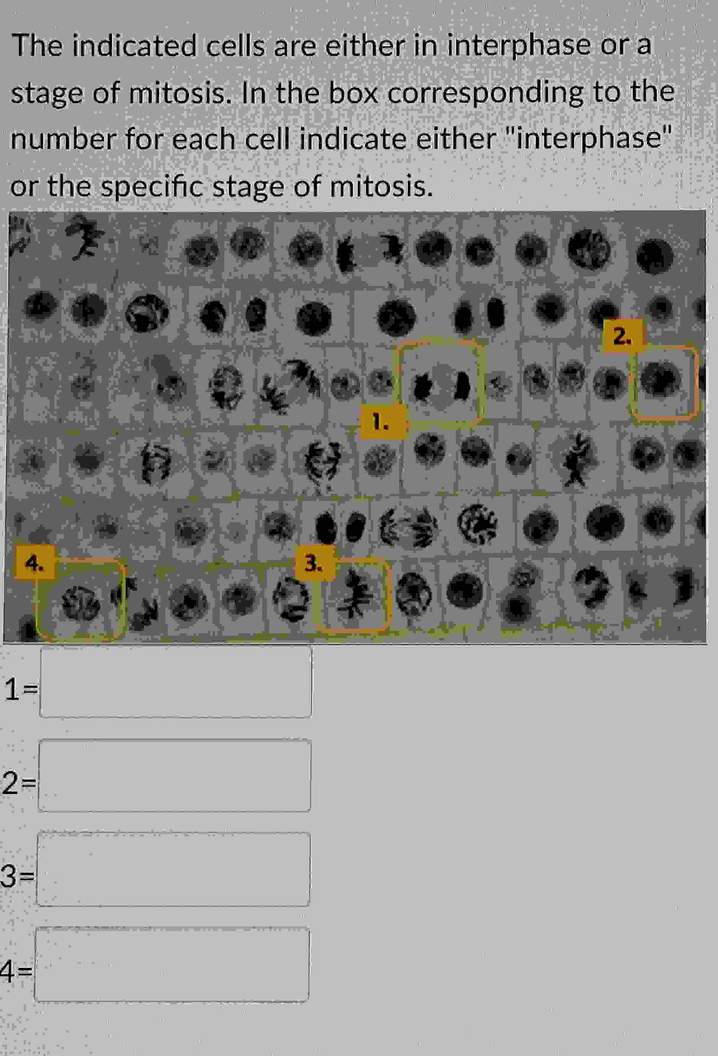 Solved The indicated cells are either in interphase or | Chegg.com