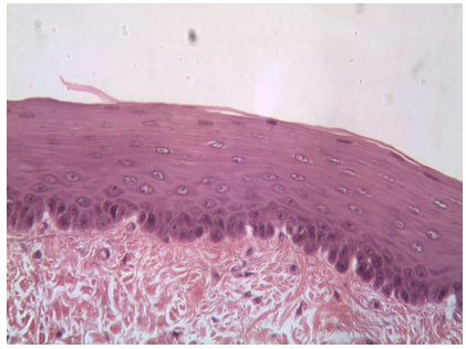 Solved Label: apical surface (the squamous-shaped cells), | Chegg.com