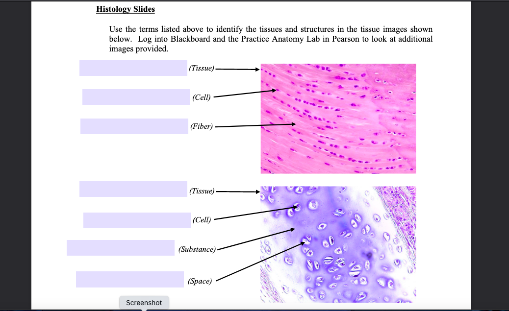 Solved Cartilage Tissues 1. Hyaline Cartilage 2. | Chegg.com