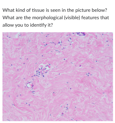 Solved In the picture below view the epithelial tissue that | Chegg.com