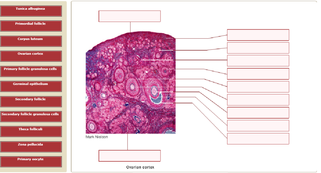 Solved Histology, Ovarian cortex Please answer the image | Chegg.com