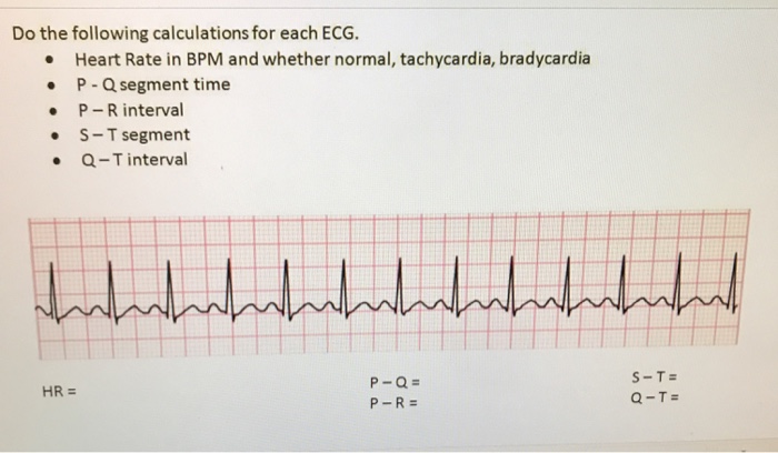 Solved Do the following calculations for each ECG. Heart | Chegg.com