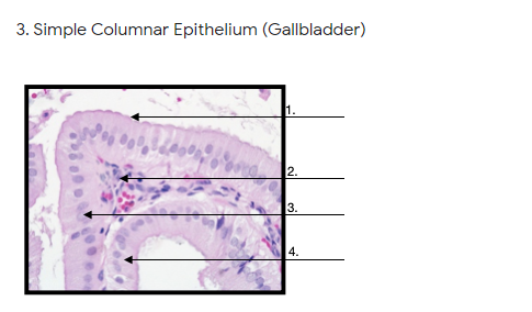 Solved 4. Simple Columnar Epithelium with Striated Borders | Chegg.com