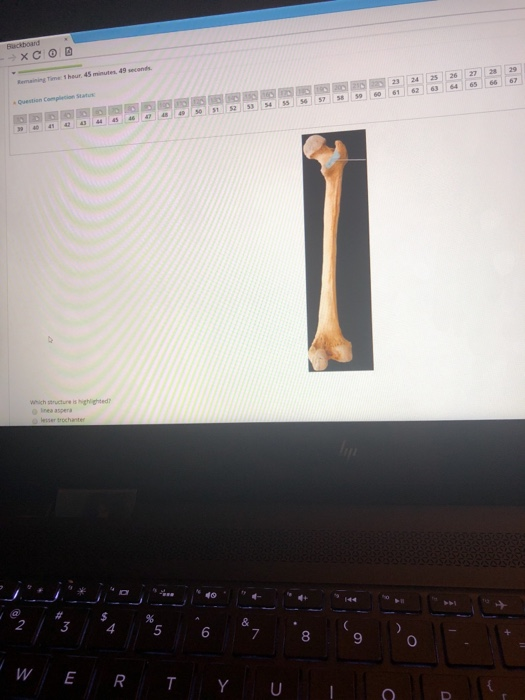 Solved Which structure is highlighted? radial notch e | Chegg.com