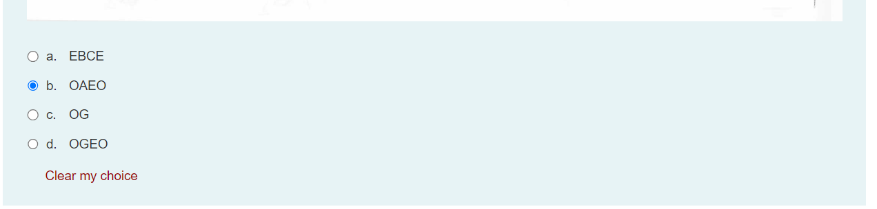 Solved Consider Graph \#4. Suppose that the government | Chegg.com Solved Consider Graph \#4. Suppose that the government | Chegg.com