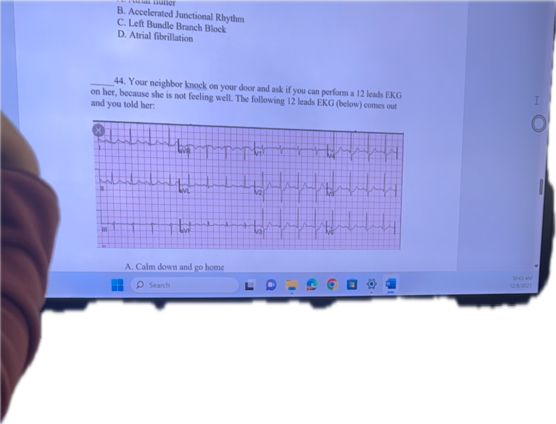 Solved Cardio Review 1. Cardiac cycle runs in systole and | Chegg.com