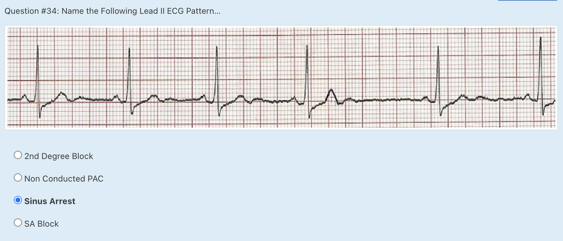 Solved Question #34: Name the Following Lead II ECG | Chegg.com