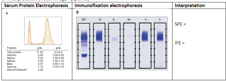 The images below are from serum protein | Chegg.com