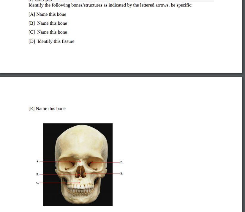 Solved Identify the following bones/structures as indicated | Chegg.com