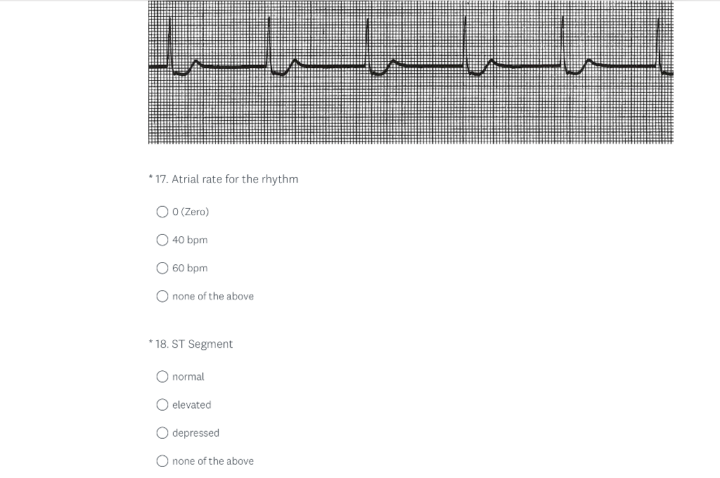 Solved * 17. Atrial rate for the rhythm O (Zero) 40bpm 60bpm | Chegg.com