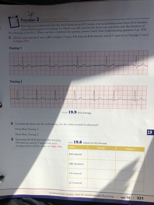 Solved TABLE 19.5 Normal Values for ECG Periods Period | Chegg.com