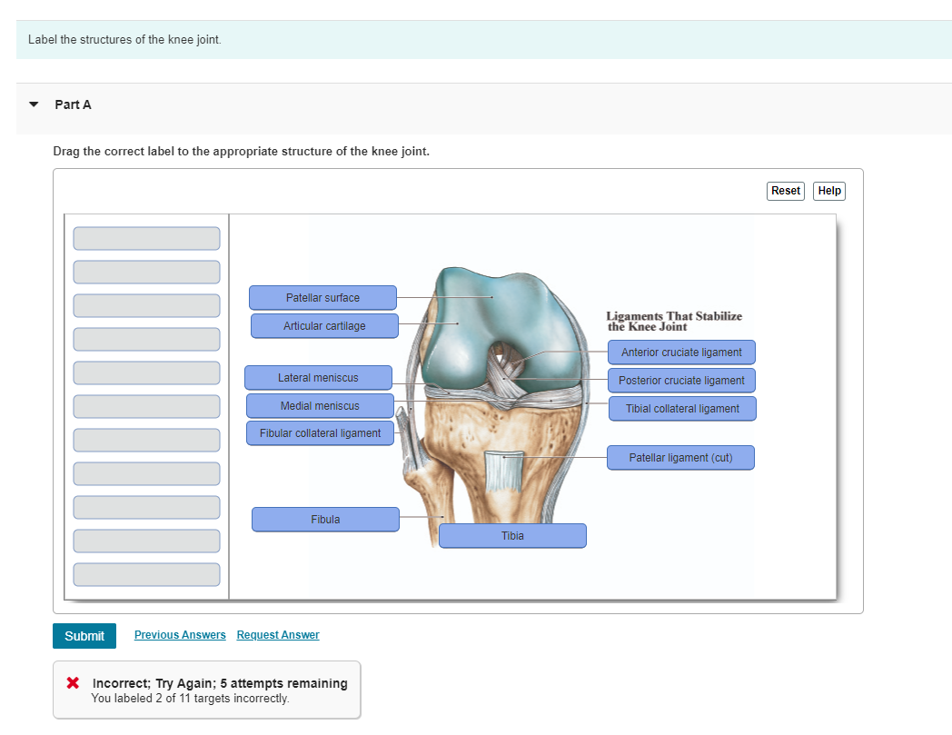 Solved Label the structures of the knee joint. | Chegg.com