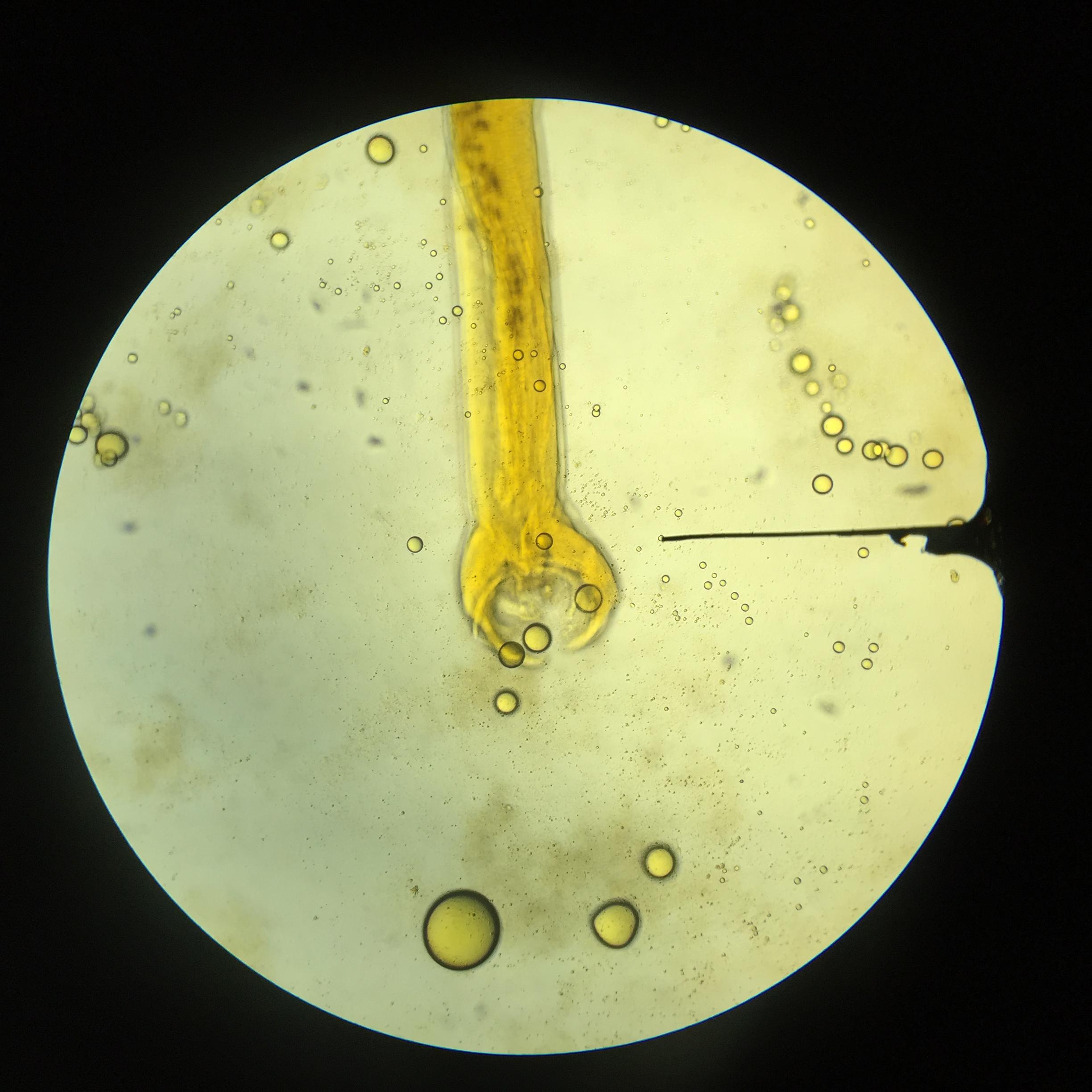 Uncinaria Stenocephala