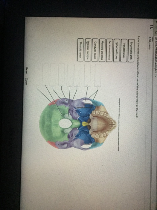 solved-label-the-bones-and-anatomical-features-of-the-chegg