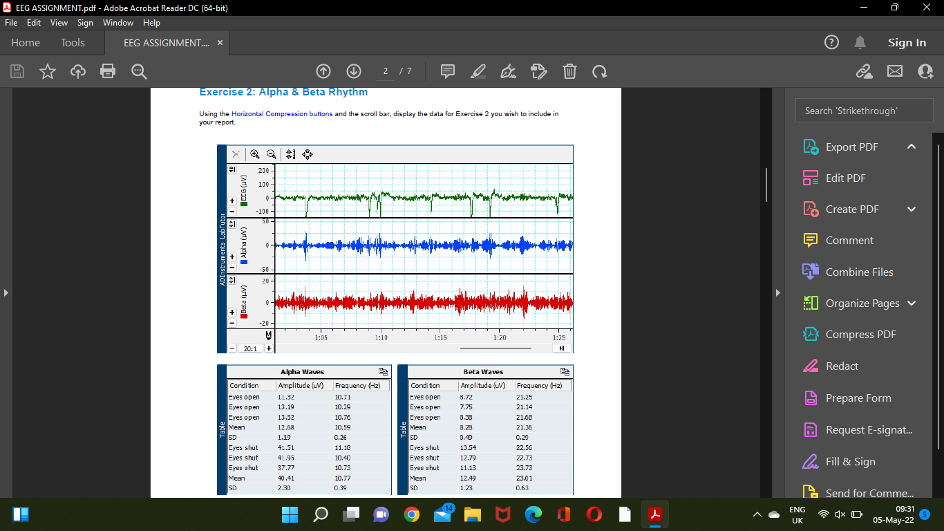X EEG ASSIGNMENT.pdf - Adobe Acrobat Reader DC | Chegg.com