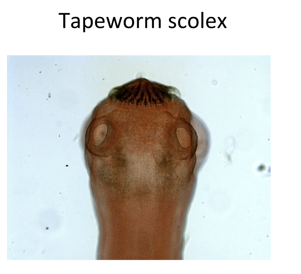Solved Tapeworm scolex | Chegg.com