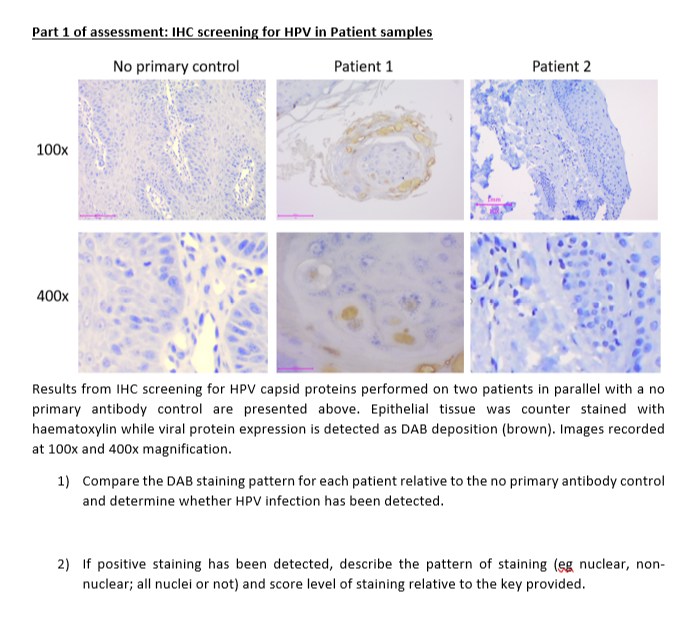 Solved Part 1 of assessment: IHC screening for HPV in | Chegg.com