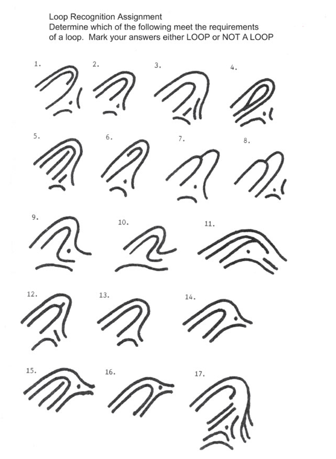 Solved Loop Recognition Assignmentdetermine Which Of The 1965