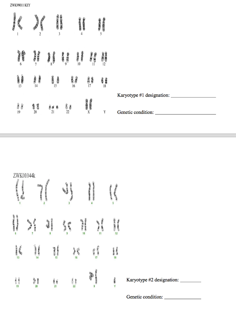 Solved WK99011 KEY 10 l6 Karyotype #1 designation: 19 20 21 | Chegg.com