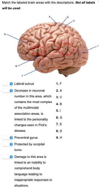 Solved Match the labeled brain areas with the descriptions. | Chegg.com