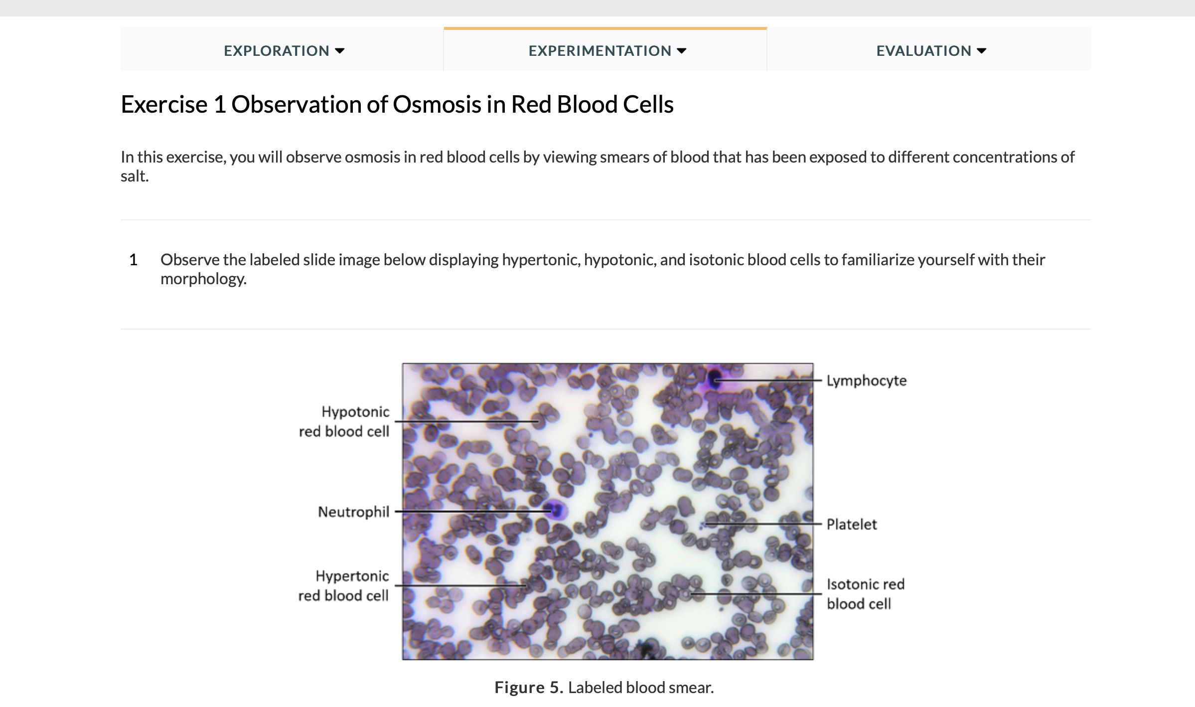 Solved Exercise 1 Observation of Osmosis in Red Blood Cells | Chegg.com
