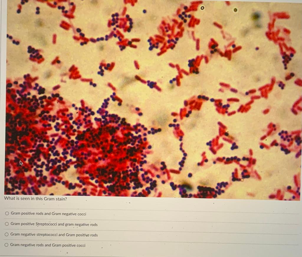 Solved Gosto What Is Seen In This Gram Stain O Gram Chegg