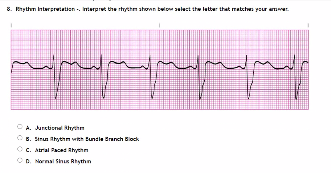 Solved 8. Rhythm Interpretation -. Interpret the rhythm | Chegg.com