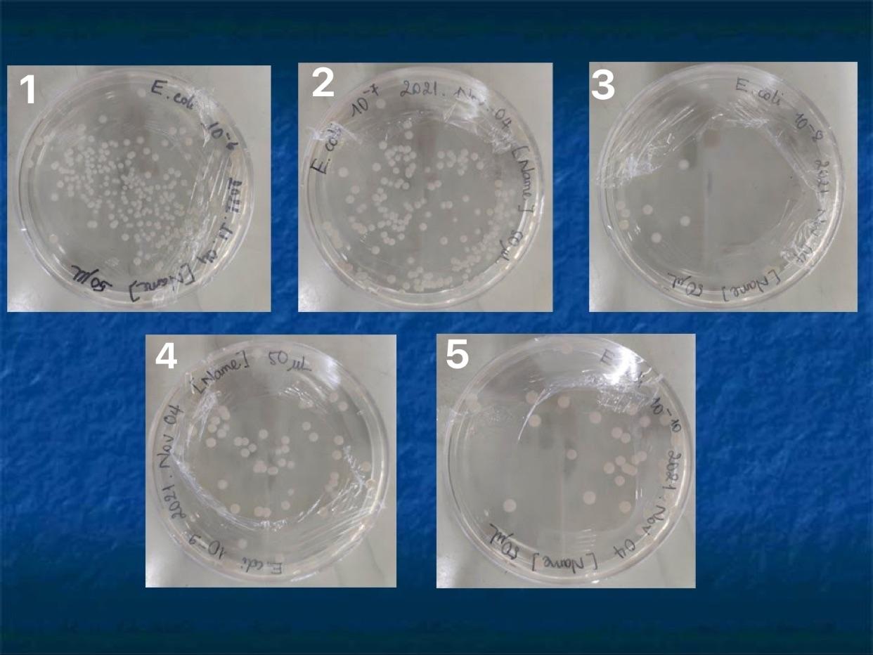 Solved Comments about the growth of E.coli in an LB-agar | Chegg.com