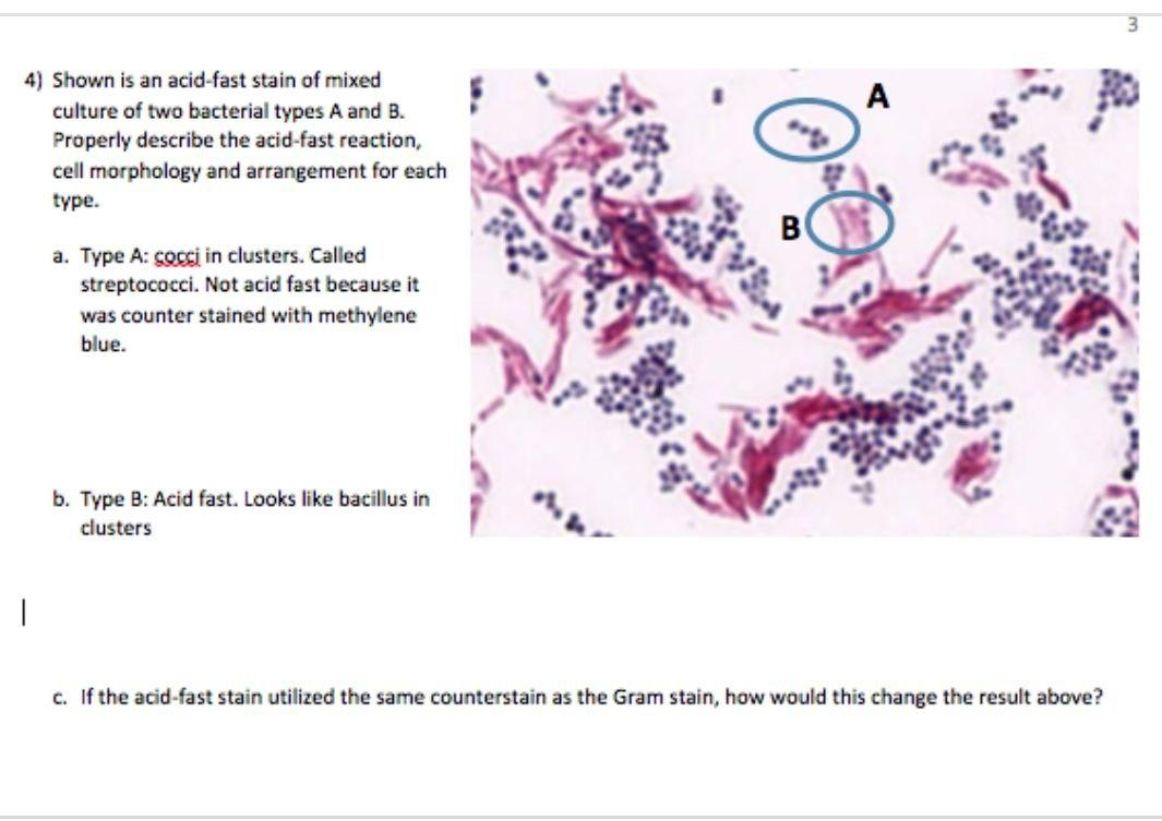 Solved A 4) Shown is an acid-fast stain of mixed culture of | Chegg.com