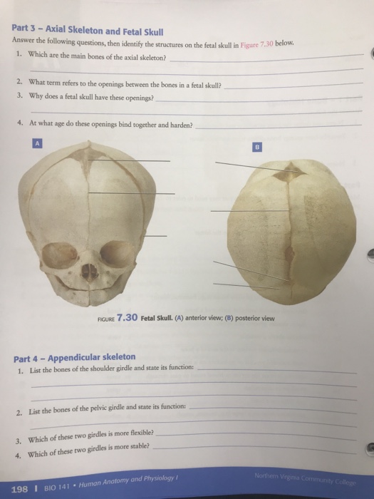 Solved Part 3-Axial Skeleton and Fetal Skull Answer the | Chegg.com