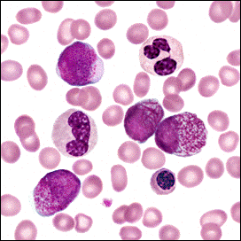 Solved Hematology Question What morphologies (RBC, WBC, | Chegg.com