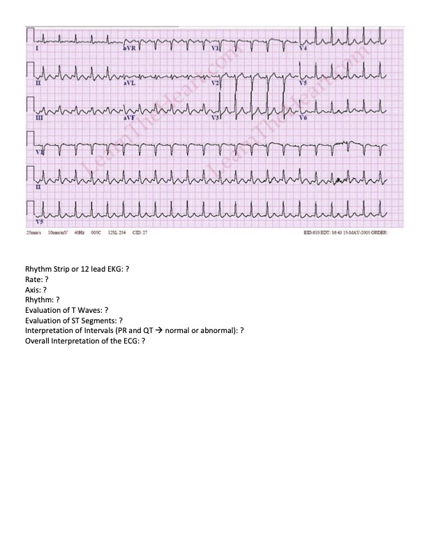 Solved Rhythm Strip or 12 ﻿lead EKG: ?Rate: ?Axis: ?Rhythm: | Chegg.com