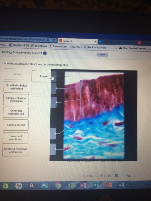 Solved Label the tissues and structures on the histology | Chegg.com Solved Label the tissues and structures on the histology | Chegg.com