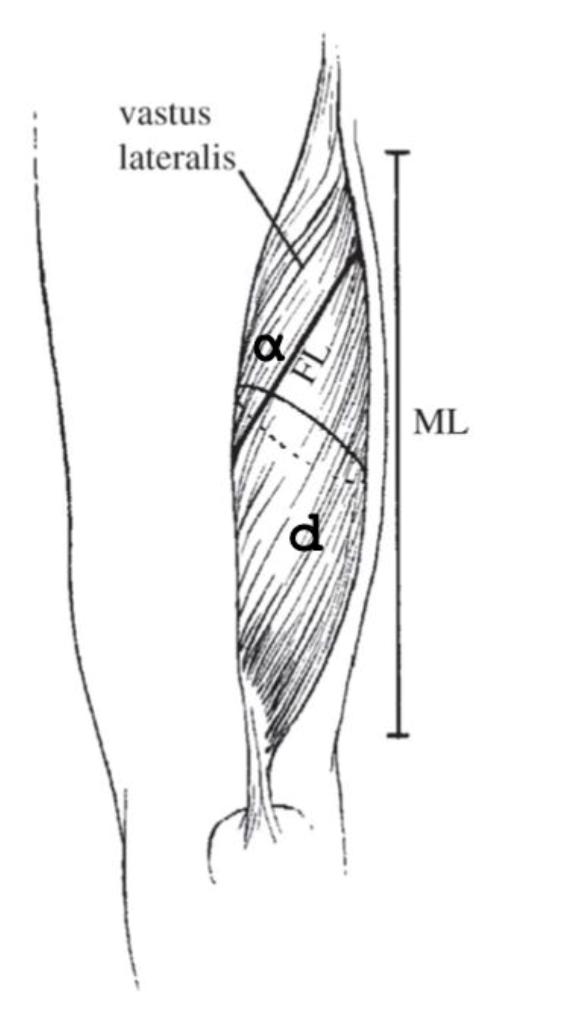 Solved The image illustrates the human vastus lateralis | Chegg.com