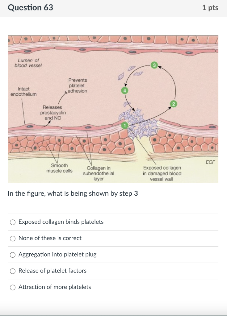 Solved In the figure, what is being shown by step 3 Exposed | Chegg.com