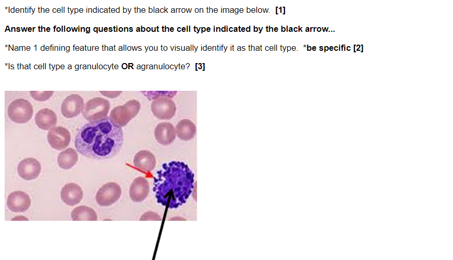 Solved *Identify the cell type indicated by the black arrow | Chegg.com