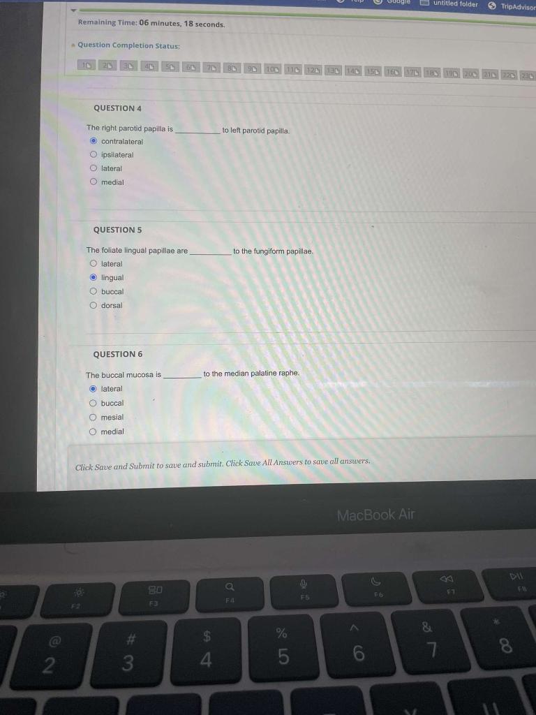 Solved QUESTION 4 The right parotid papilla is to leit | Chegg.com