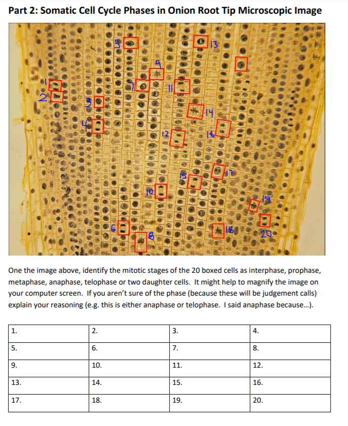 Solved Part 2: Somatic Cell Cycle Phases in Onion Root Tip | Chegg.com