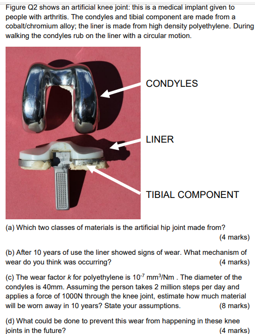Solved Figure Q2 shows an artificial knee joint: this is a | Chegg.com