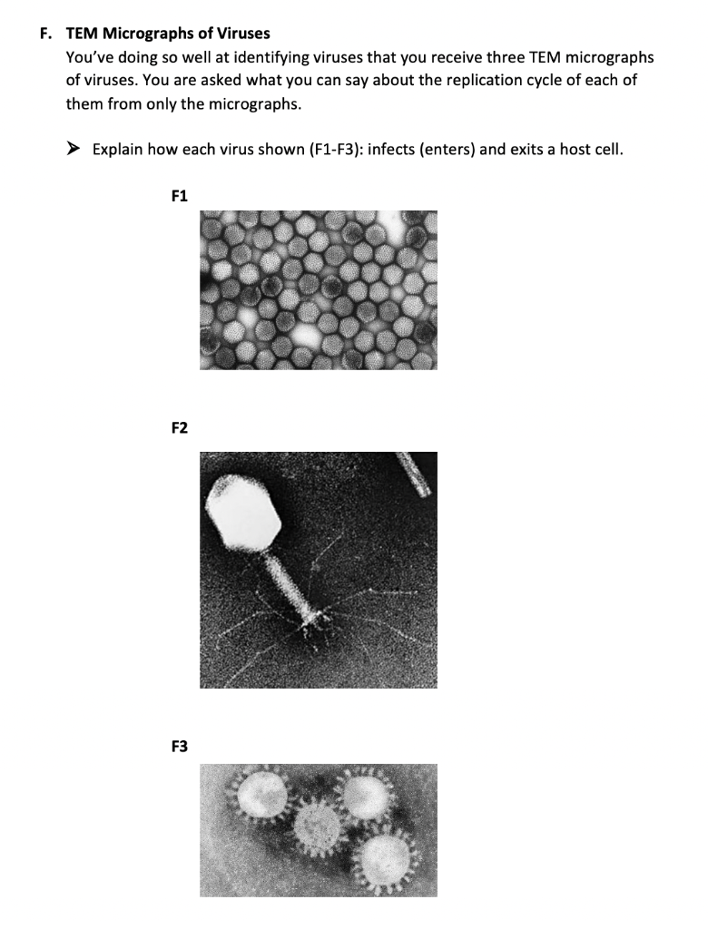 Solved TEM Micrographs of Viruses You’ve doing so well at | Chegg.com