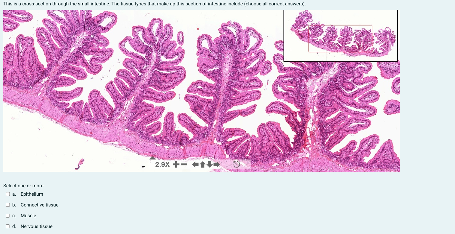 Solved The loops of small intestine Select one: a. Have an | Chegg.com