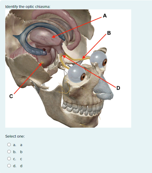 Solved From the following labeled structures, identify the | Chegg.com