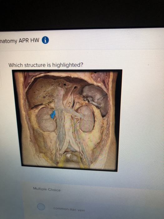 tory Anatomy APR HW G Which structure is highlighted? | Chegg.com