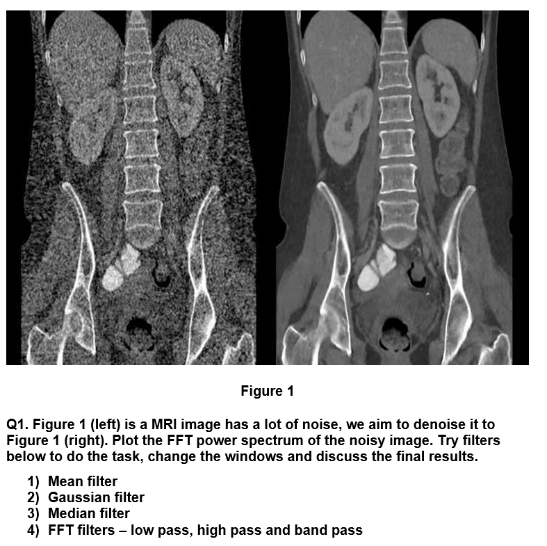 Solved Q1. Figure 1 (left) is a MRI image has a lot of | Chegg.com