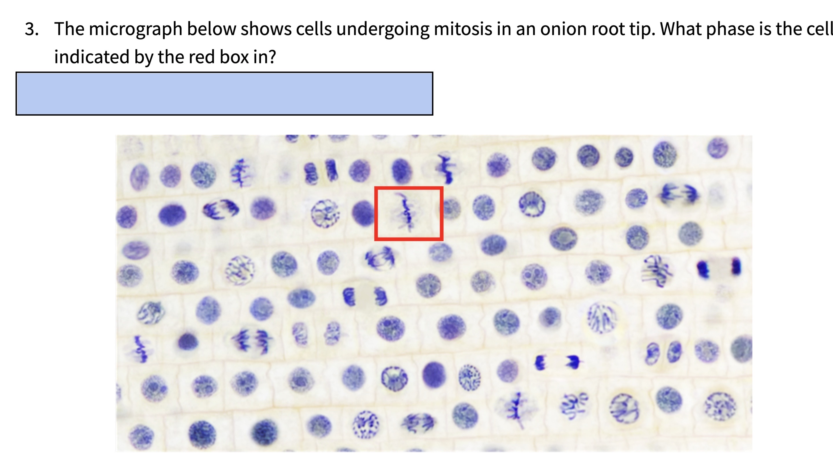 Solved 3. The micrograph below shows cells undergoing | Chegg.com