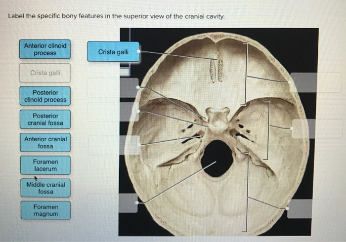 Solved Label the specific bony features in the superior view | Chegg.com Solved Label the specific bony features in the superior view | Chegg.com