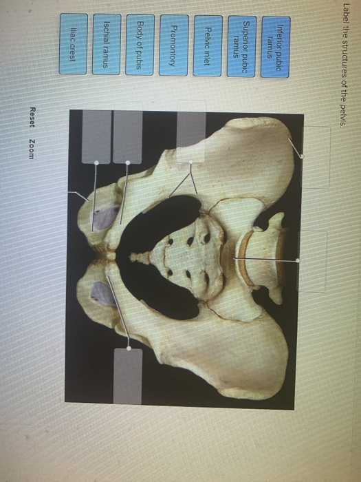 Solved which structure is highlighted le x | Chegg.com