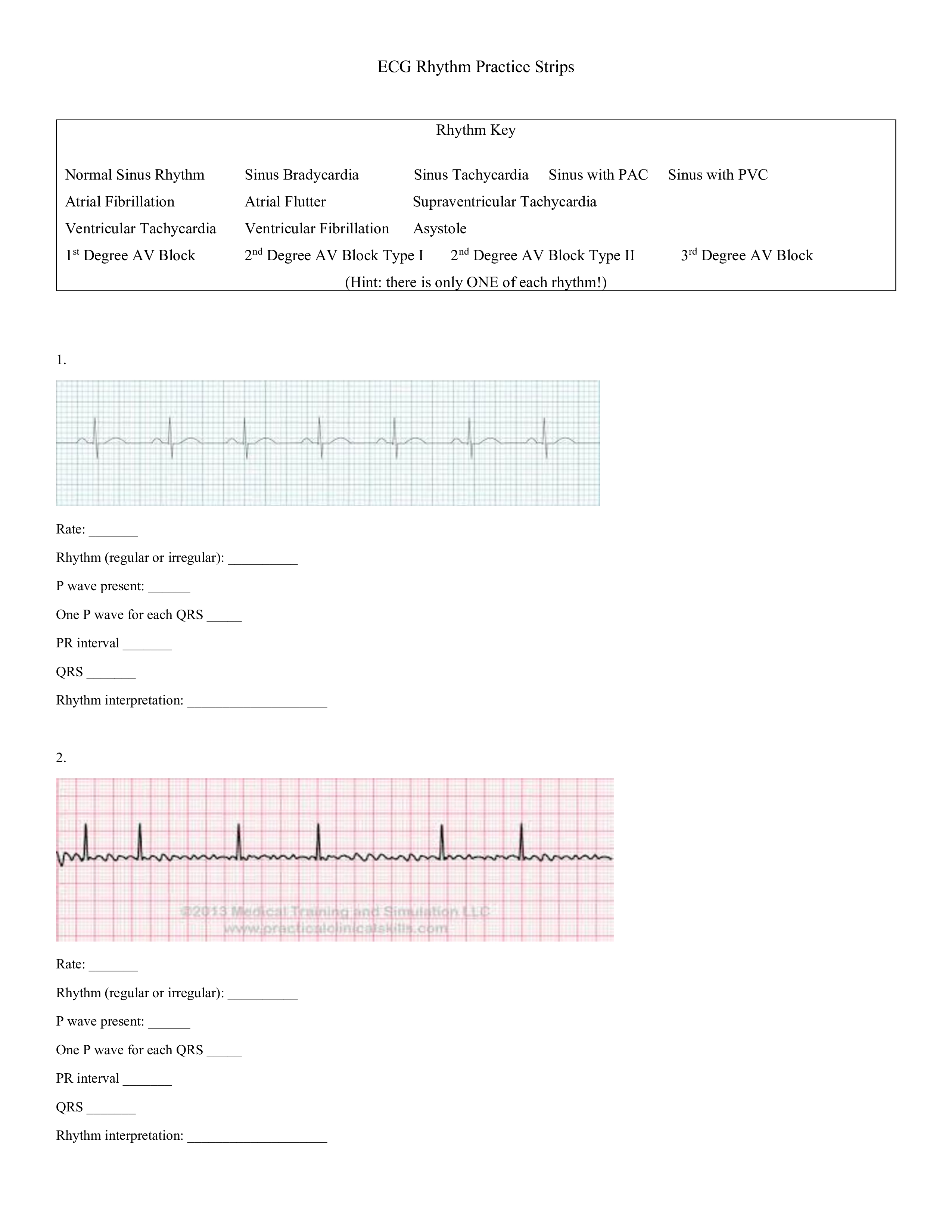 Solved ECG Rhythm ﻿Practice StripsRhythm ﻿KeyNormal Sinus | Chegg.com