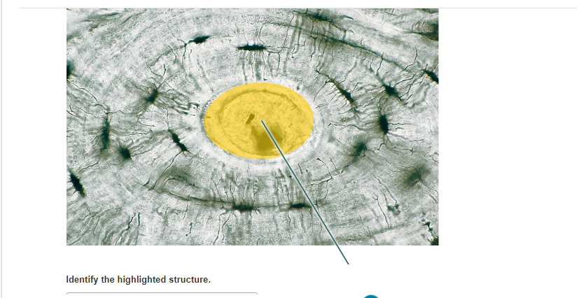 Solved Identify the highlighted structure. | Chegg.com
